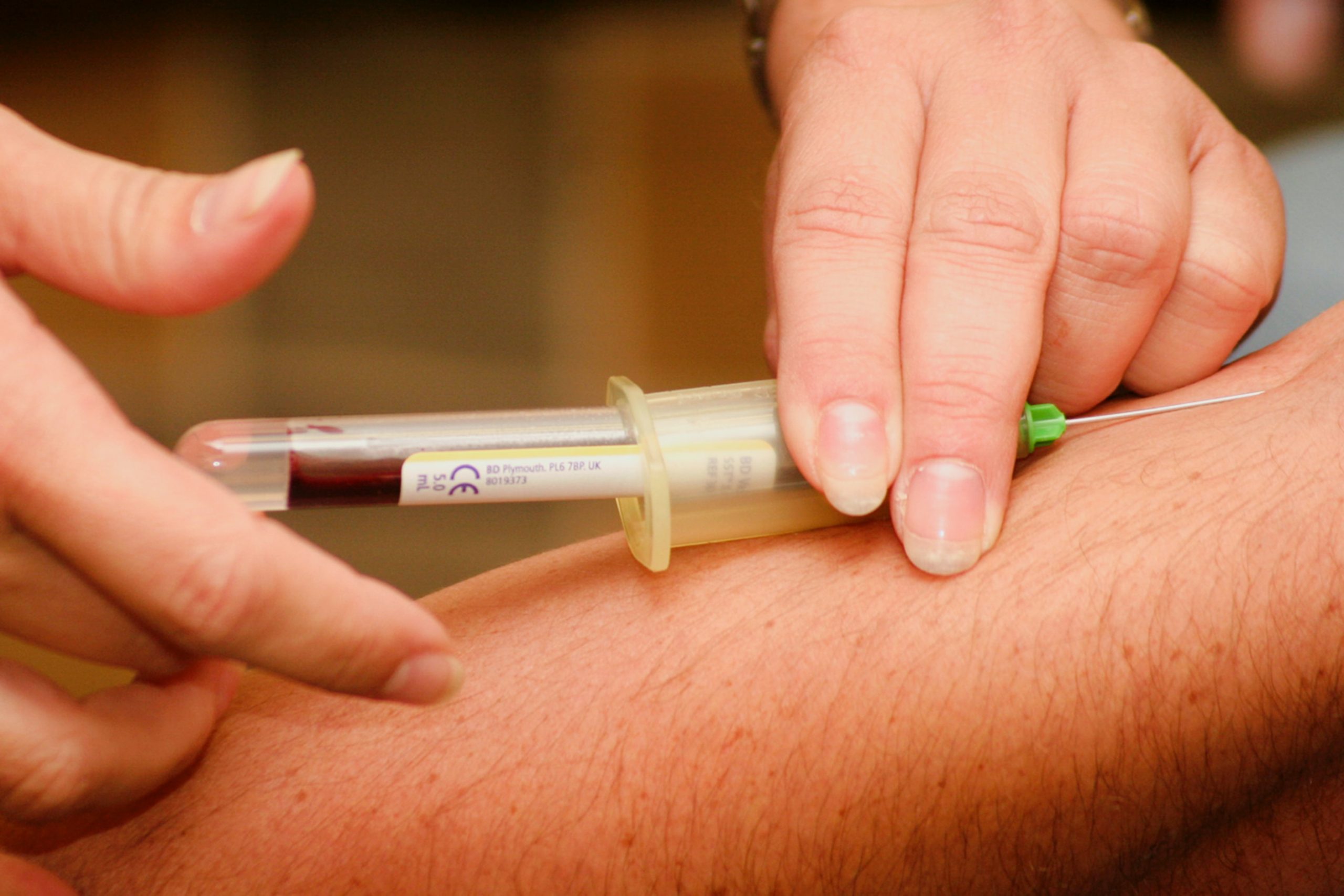 A Career in Phlebotomy: What You Need to Know before Entering College
